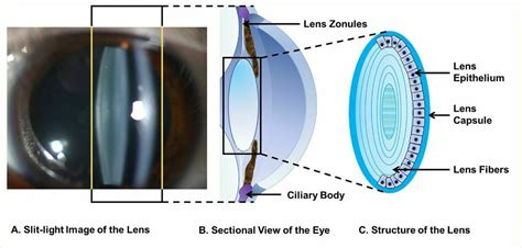 The Eye Lens What You Need To Know