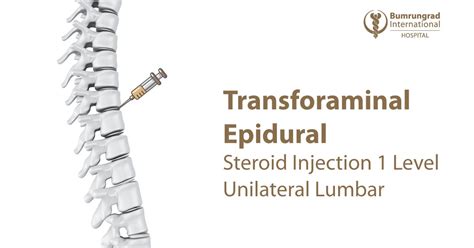 Transforaminal Epidural Steroid Injection 1 Level Unilaterallumbar