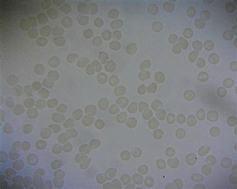 He1008690 Philip Harris Prepared Microscope Slide Human Blood Smear