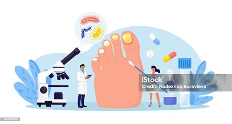 손발톱 진균증 손톱 질환이있는 발 곰팡이 손톱 감염 의사 검사 손톱 건선 치료 의사 피부과 전문의는 건선 발톱을 분석합니다 발톱