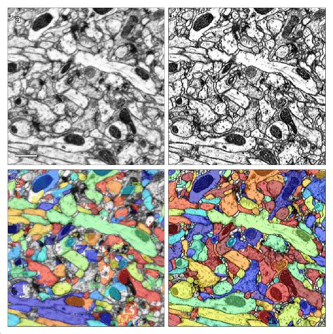 Examples Of Results Of Cyclegan Processing A Original Em Data From