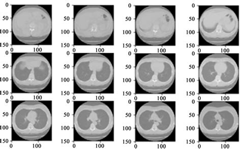 lung cancer detection using ct image based on 3d convolutional neural