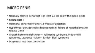 Abnormalities Of External Genital Tractpptx