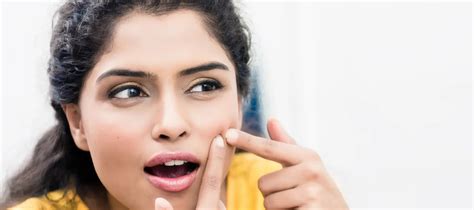 Early Pregnancy And Pimples Understanding Causes And Treatment Of Pimples In Early Pregnancy