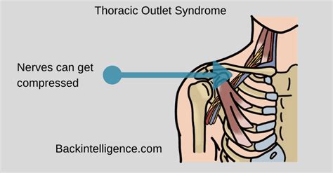Thoracic Plexus