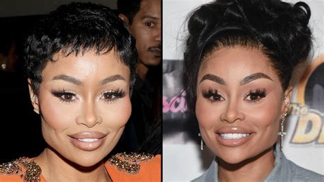Blac Chyna Posts Face Transformation Video After Dissolving All Her