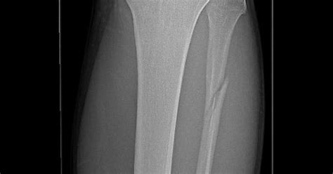 Why You Dont Sweep The Leg Album On Imgur