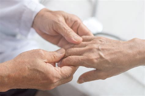 Understanding Systemic Sclerosis Scleroderma The Doctor Weighs In
