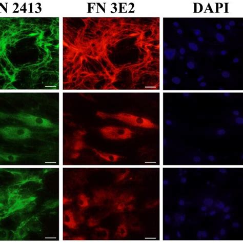 An Influences Fn Structure In Ecm From Cells Cultured In Growth Media