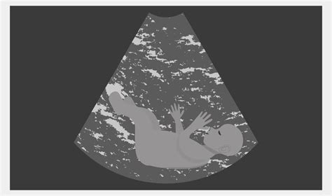 초음파 검사 절차 임신 초음파 스캔에서 배아 프리미엄 벡터