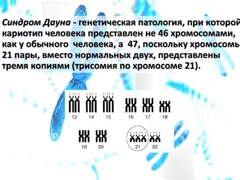 Формирование жизненных компетенций у детей с синдромом Дауна Online Presentation