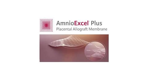 Integra Lifesciences Launches Amnioexcel Plus Placental Allograft Membrane Medical Product