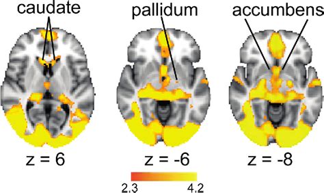 Figure 4 From Neurobehavioral Markers Of Resilience To Depression