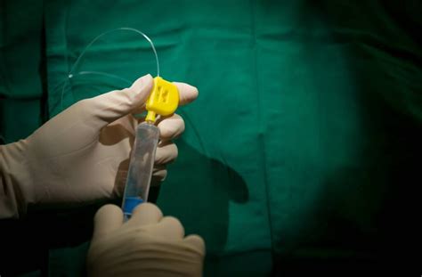 Indications For Continuous Nerve Block