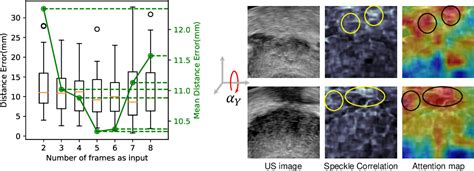 Sensorless Freehand 3d Ultrasound Reconstruction Via Deep Contextual Learning
