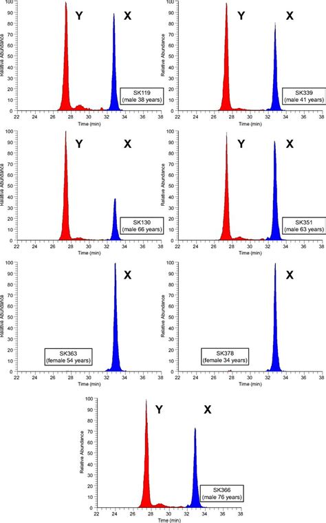 Sex Determination Of Human Remains From Peptides In Tooth Enamel PNAS