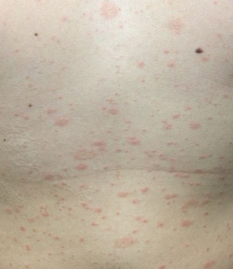 장미색 비강진 네이버 블로그