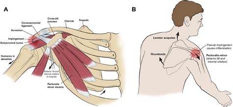 Scapular Dyskinesia Dr Rahul Bade
