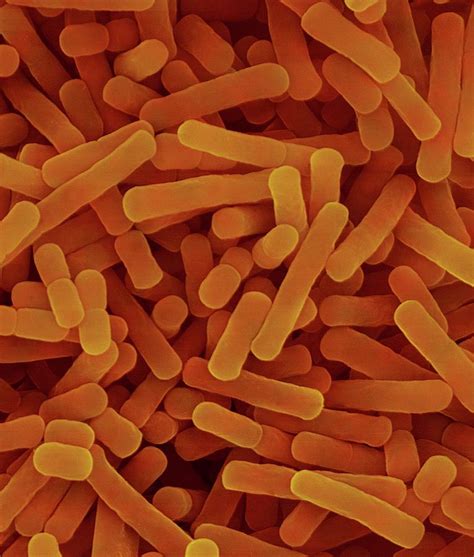 Lactobacillus Bulgaricus 4 By Science Photo Library