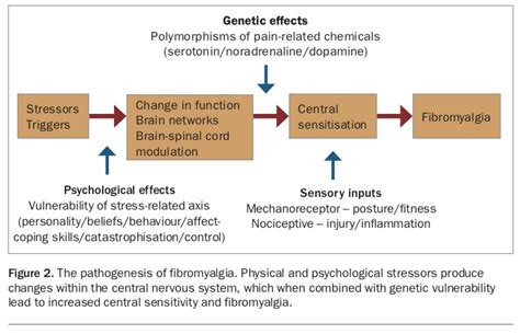 Fibromyalgia Diagnosis And Management In General Practice Medicine Today