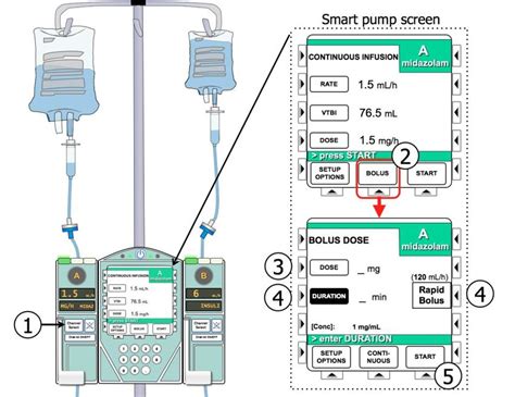 Administering An Iv Pump Bolus Smart Pump Dedicated Bolus Feature Download Scientific Diagram