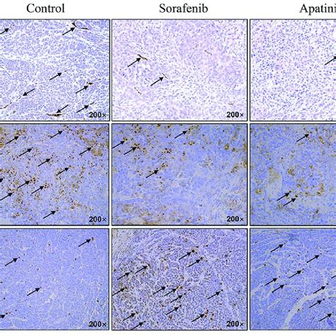 Bli Images And 3d Blt Reconstruction Of Orthotopic Liver Tumors N