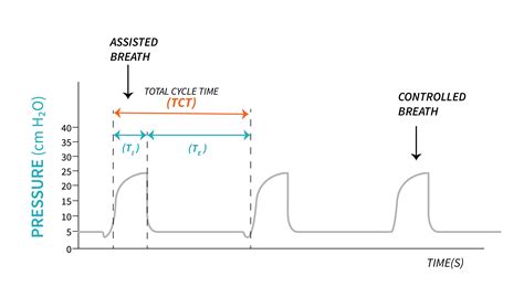 24 Phase Variables Control Vs Spontaneously Initiated Breaths