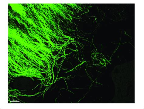 Clsm Observation Of Phaeoacremonium Minimumgfp7 From A Pure Mea Download Scientific Diagram