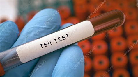 Thyroid Stimulating Hormone Tsh Test Conceptual Image Stock Image F036 7517 Science