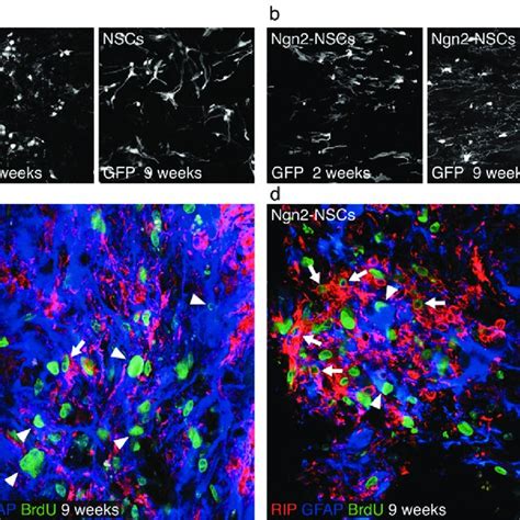 Schematic Illustration Of A Segmental Spinal Cord Circuit Connecting