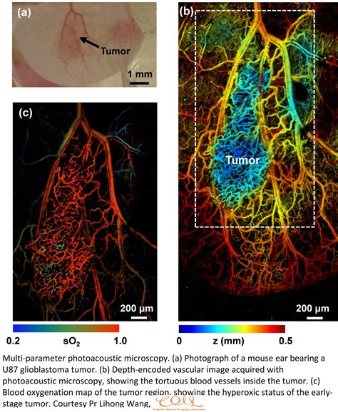 Medical Optical Imaging SFPMed