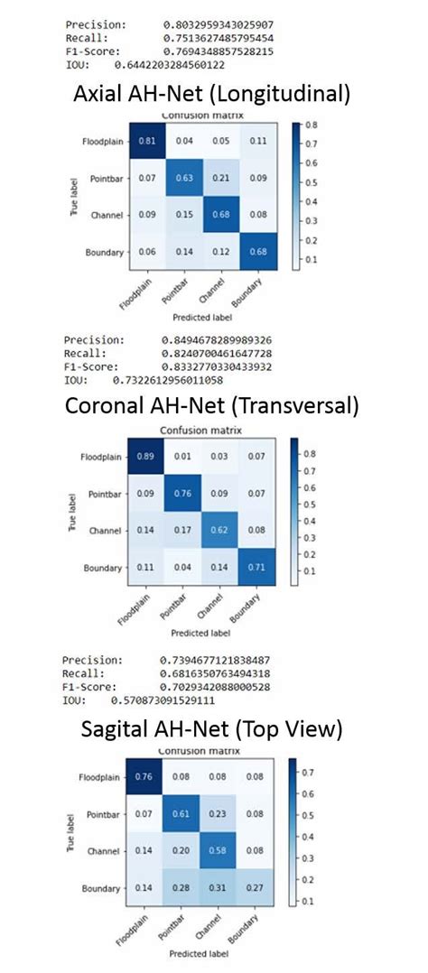 Confusion Matrix Of The 2d Unet For Each Orthogonal Plane Download Scientific Diagram
