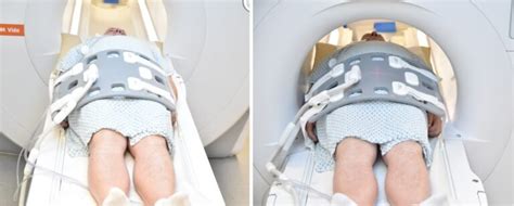 Mri Arthrogram Hip Protocol And Planning Indications For Mri