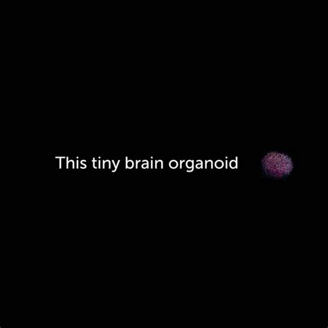 [video] Frontiers In Science On Linkedin Organoid Intelligence Oi Could Transform Biological