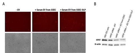 Smartsec Delipo™ Advanced Sev Isolation Kit System Biosciences