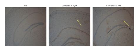 Ap39 Reduced Aβ Production And Aβ Deposition In App Ps1 Mice A B