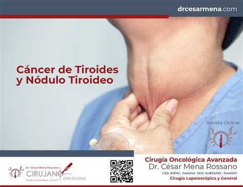 Cáncer De Tiroides Y Nódulo Tiroideo Dr César Mena Rossano