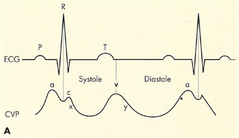 Cardiac Cycle And Pressure Volume Loops Flashcards Quizlet