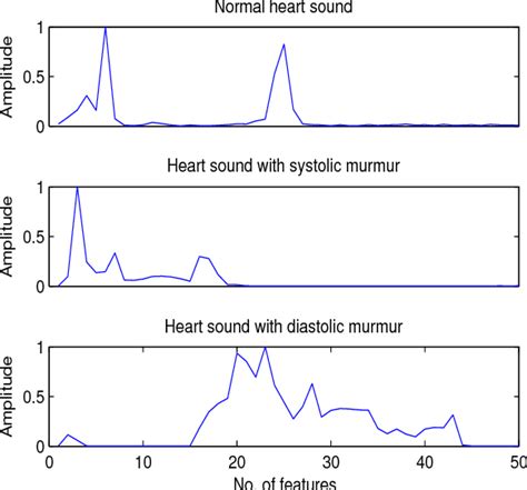 Figure 1 From Classification Of Heart Murmurs Using Cepstral Features And Support Vector
