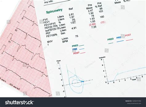 Close Pulmonary Report Showing Spirometry Graph Stock Photo Shutterstock