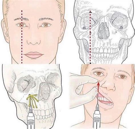 Trigeminal Nerve Cranial Nerves Anatomy Dental School Dentistry