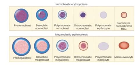 Macrocytic Anemia Flashcards Quizlet