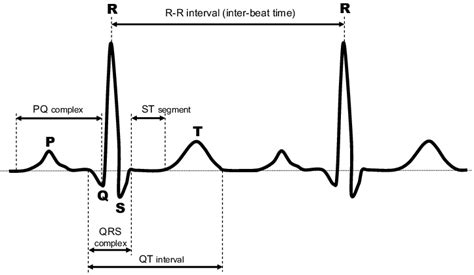 A Normal Electrocardiogram Download Scientific Diagram