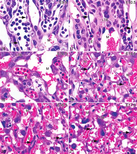 E95 Mouse Placental Labyrinth The Embryonic Endothelial Cells
