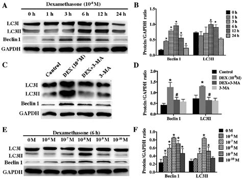 Effect Of Dex On The Expression Of Lc3ii And Beclin 1 In Hfob 1 19 Download Scientific Diagram