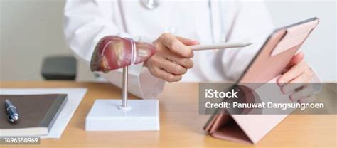 인간 간 모델과 태블릿을 가진 의사 간암 및 종양 황달 바이러스성 A B C D E 간경변 부전 비대 간성 뇌병증 복수액 및 건강 10월에 대한 스톡 사진 및 기타 이미지