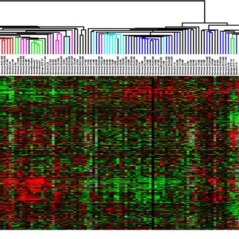 Global Gene Expression Profiling Of Breast Tumour Cell Lines A