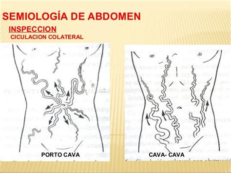 Semiologia Abdominal