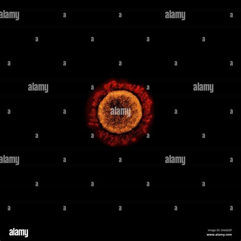 Transmission Electron Micrograph Of A Sars Cov 2 Virus Particle Uk B 1 1 7 Variant Isolated