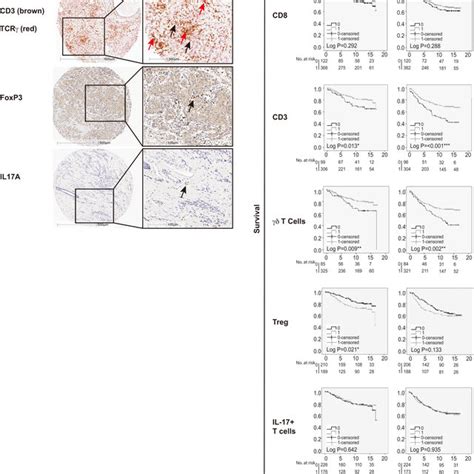 Ihc Staining Of T Cell Subpopulations In Breast Cancers And Association Download Scientific
